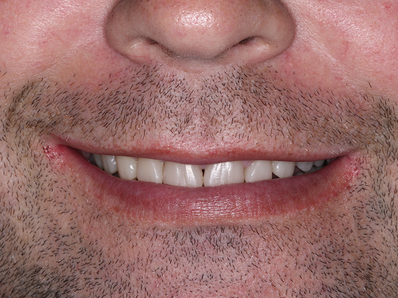 BIOESTHETIC DENTISTRY - Skyline Family Dentistry | Grove St. Bishop