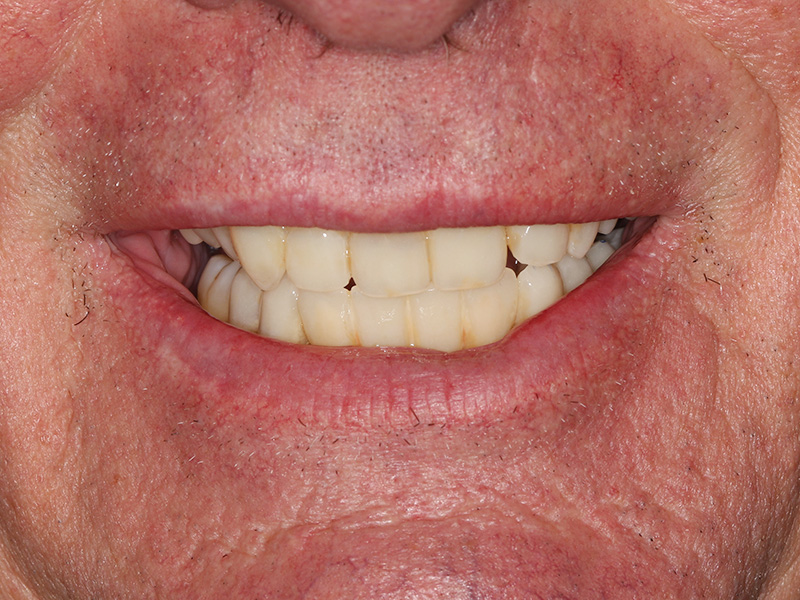 BIOESTHETIC DENTISTRY - Skyline Family Dentistry | Grove St. Bishop